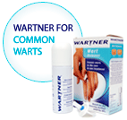 Wartner | Wartner Removers
